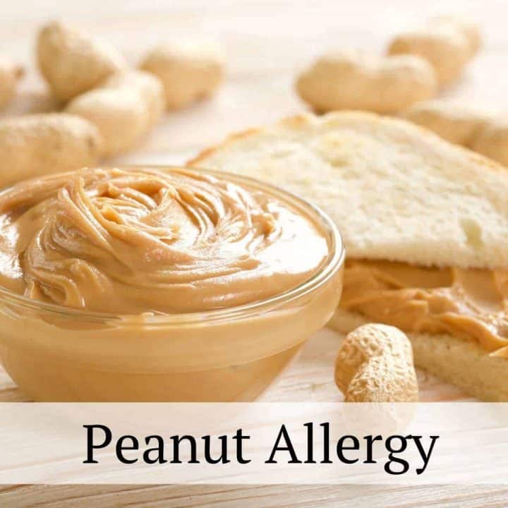 Peanut Allergy: How to Manage It | Eating With Food Allergies